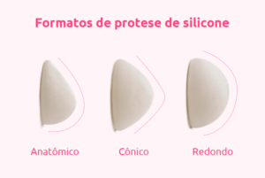 Tudo sobre prótese de silicone, Valores, modelos e cirurgia